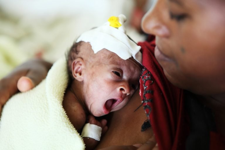 International Kangaroo Mother Care (KMC) Awareness Day – NICHE ...